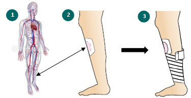 Guidelines For Use – Ligamed