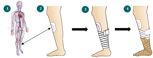 Guidelines For Use – Ligamed